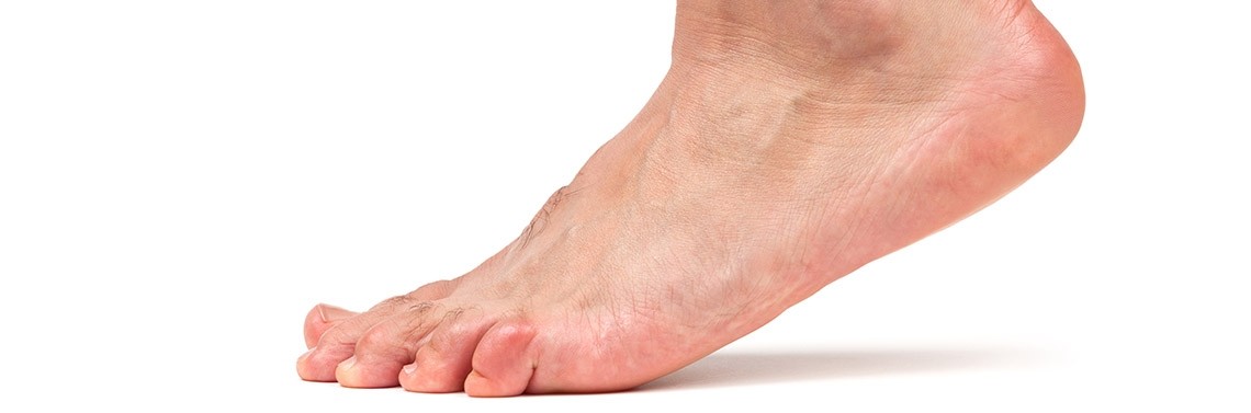 Wady i choroby stóp według Mortona i ich wpływ na powstawanie zaburzeń ...