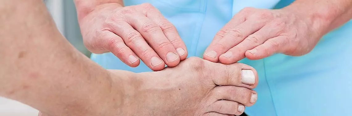 Rehabilitacja po operacji artrodezy stawu MTP I w leczeniu ...