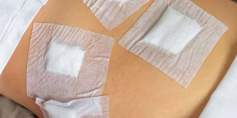 Trudno gojące się rany pooperacyjne. Jak pomóc pacjentowi? - Praktyczna ...